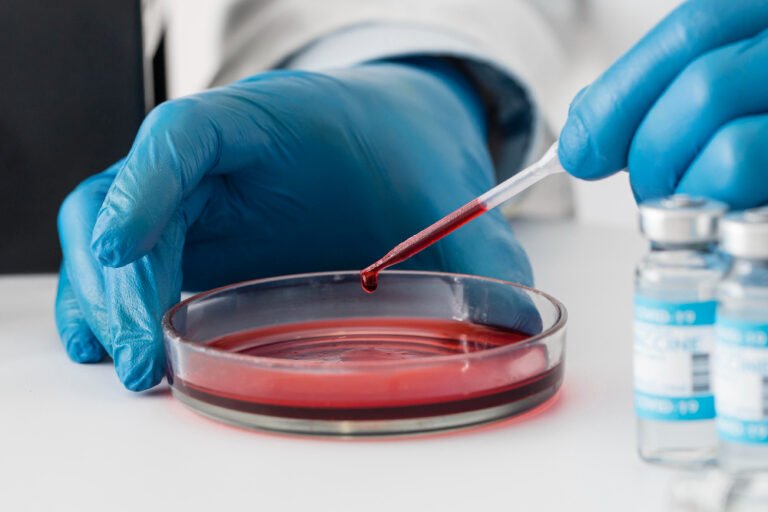 Blood culture & sensitivity - Get Well PathLabs